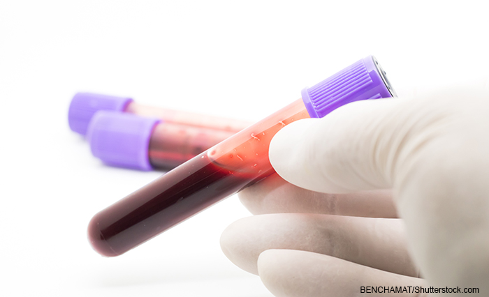 LSU Health Sciences Physician Lead Investigator on Groundbreaking ...